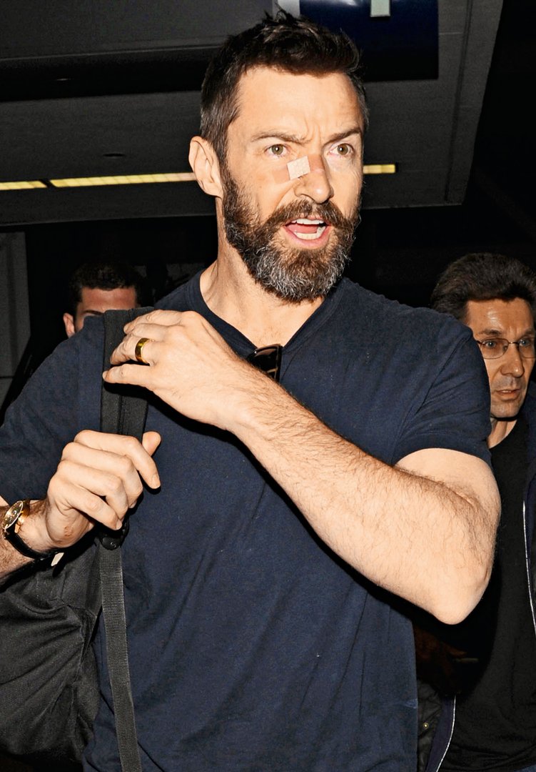 Hugh Jackman: Rak se je vrnil - Govori.se