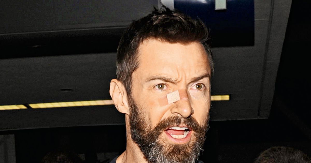 Hugh Jackman: Rak se je vrnil - Govori.se