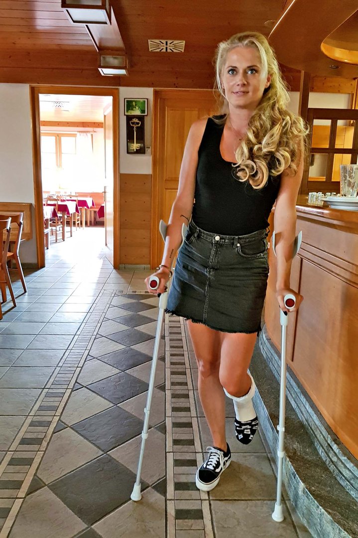 Maša Merc doživela nesrečo - hud padec in zlom noge - Govori.se